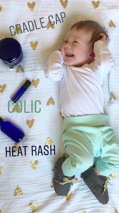 Cradle Cap, Colic, & Heat Rash – The Nurtured Bee